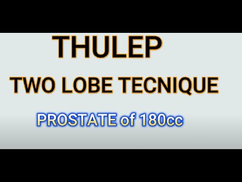 Thulep real life. Enucleation in two lobes of a large prostate (180 cc ...