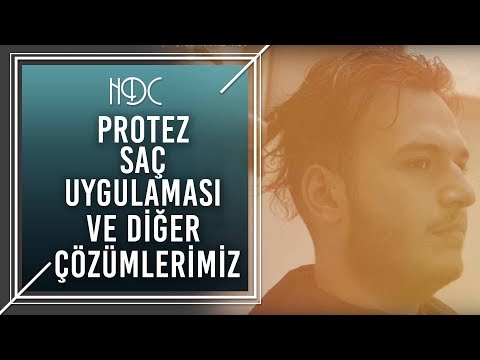 Protez Saç Uygulaması Ve Diğer Çözümlerimiz - HDC