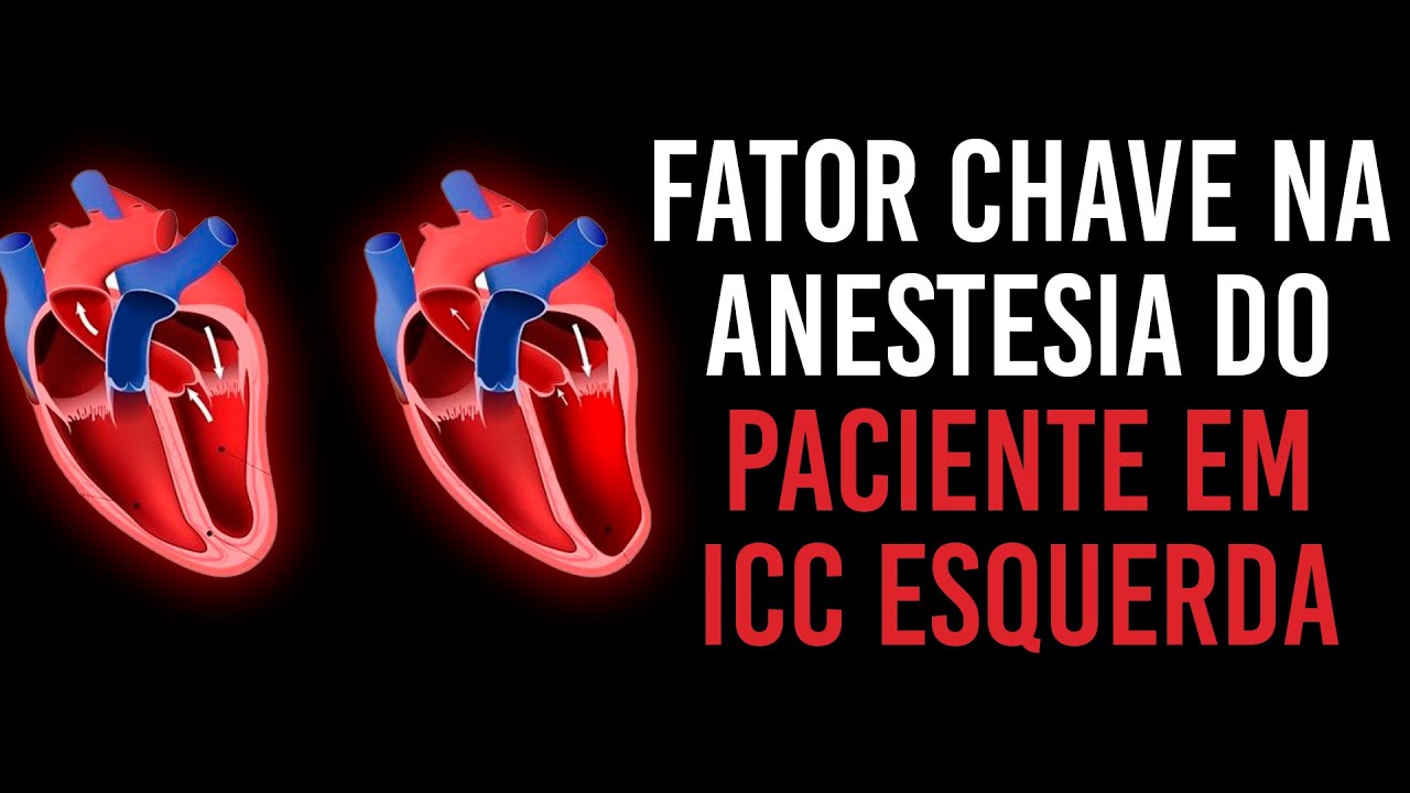 Fator chave na anestesia do paciente em ICC esquerda - YouTube