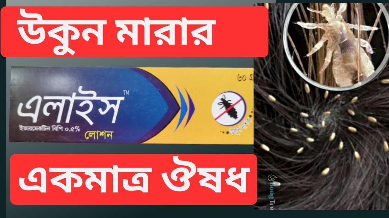 Alice lotion: ivermectin:aLice medicine: উকুন মারার ঔষধ: কিভাবে উকুন ...