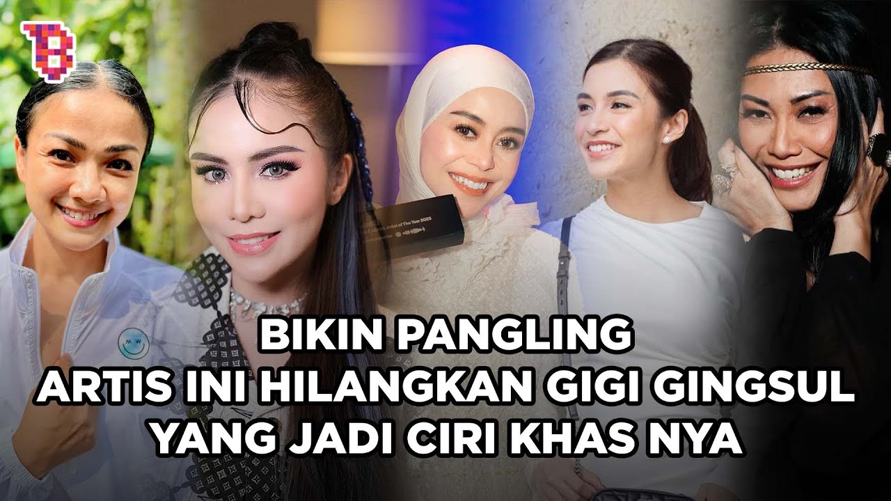 Transformasi 5 artis usai hilangkan gigi gingsul, bikin pangling - YouTube