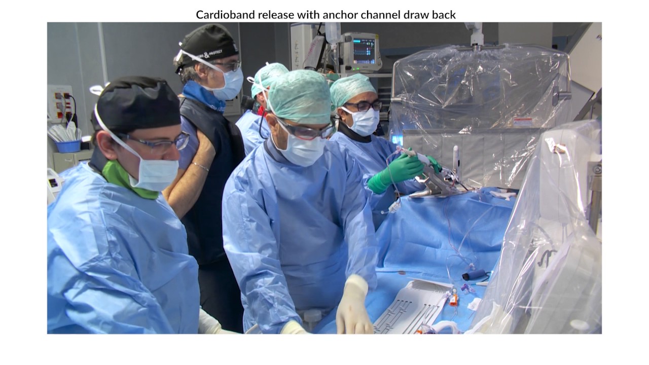 Cardioband Procedure in San Raffaele Hospital - YouTube