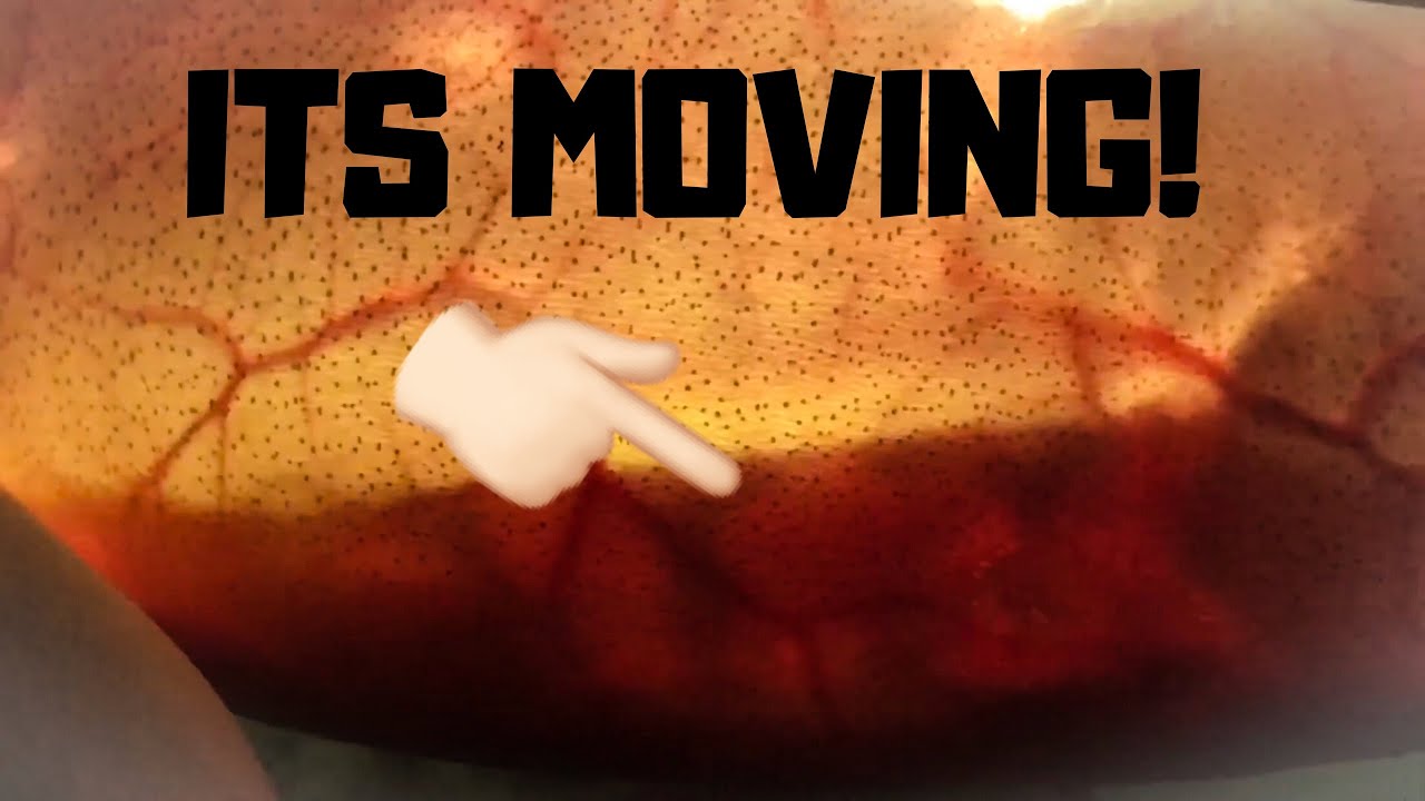Ball Python Embryo Moving inside of the EGG!!! - YouTube