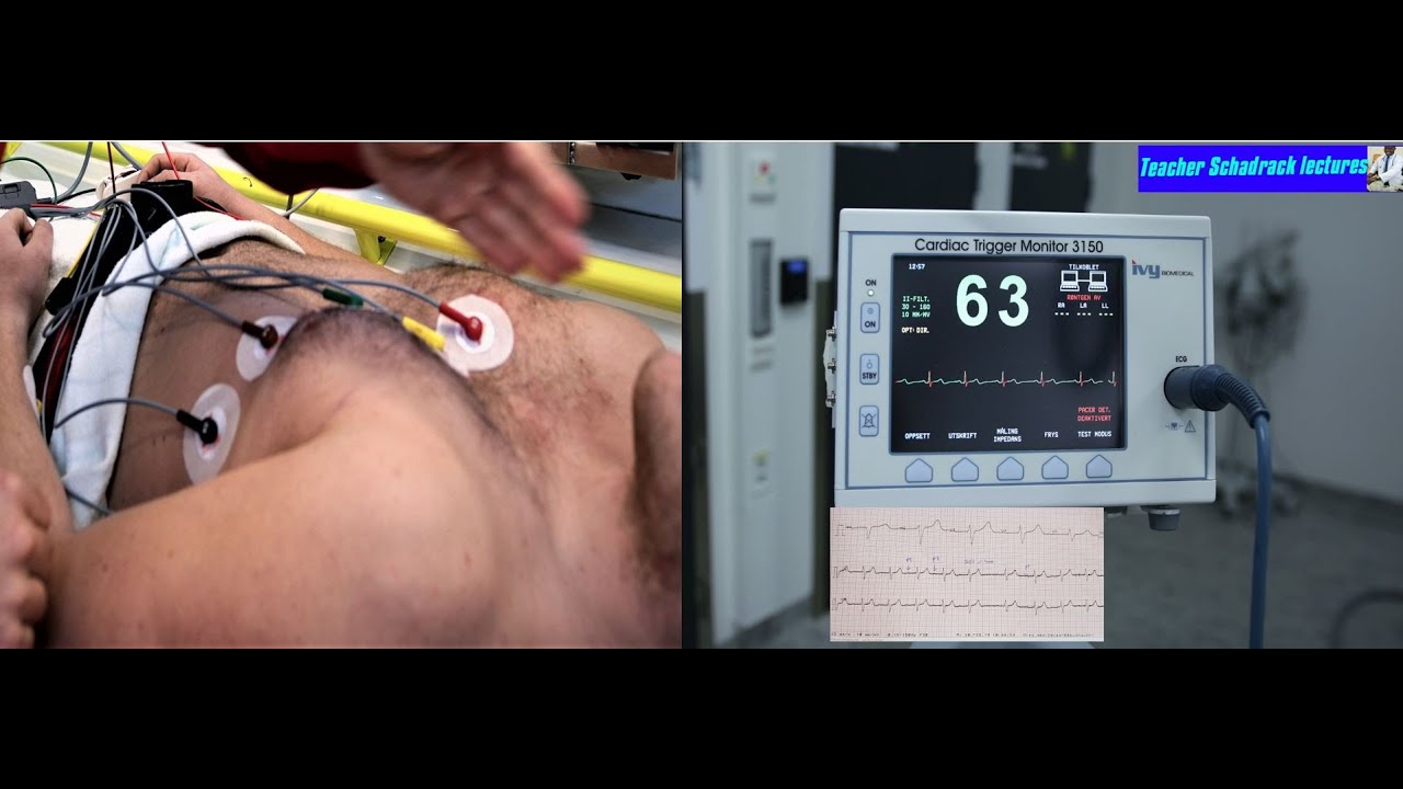 What is ECG or EKG. Learn these: #ECG leads, electrodes placement and ...