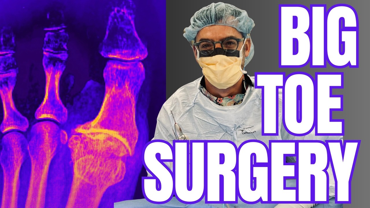 Surgery for big toe arthritis - YouTube
