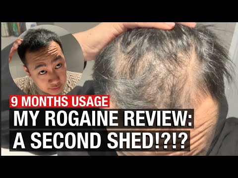 9 MONTHS USAGE: MY ROGAINE REVIEW, A SECOND SHED?!?!