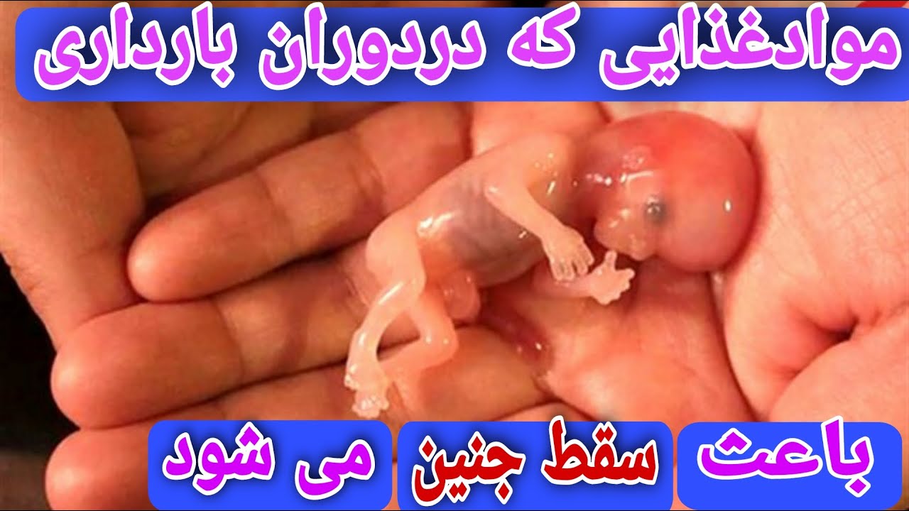 جلوگیری ازسقط جنین موادغذایی که اگر در دوران بارداری استفاده شود باعث