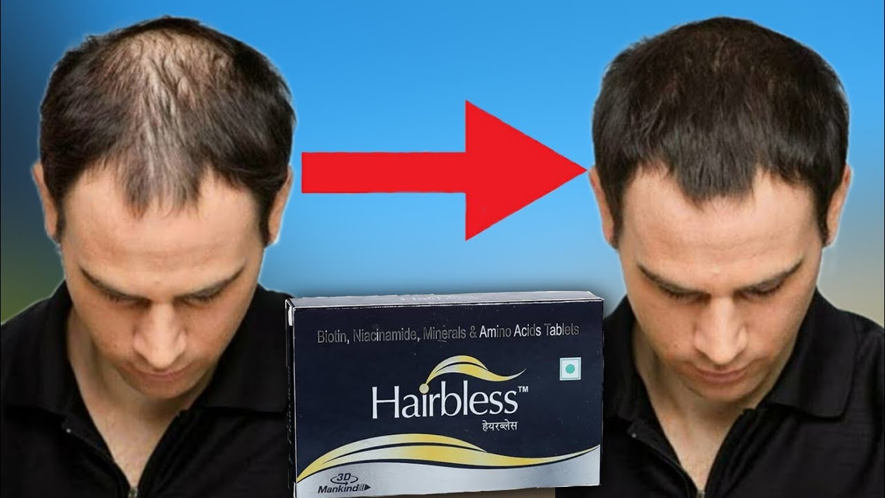 Hairbless Tablet Review | hair Regrowth tablet benefits - YouTube