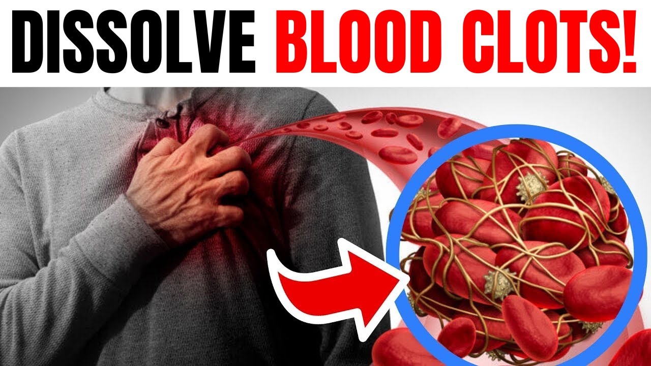 TOP 6 Vitamins To DISSOLVE Your BLOOD CLOTS - YouTube