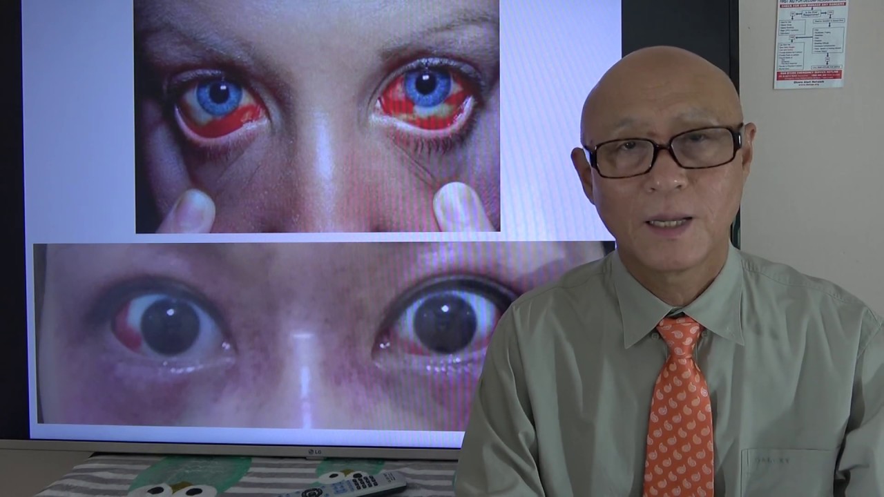 0089 강영천의 스쿠버 다이빙 이야기 - 눈 08 마스크 스퀴즈(mask squeeze) - YouTube