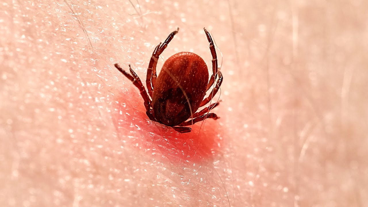 Creatures Living INSIDE The Human Body! - YouTube