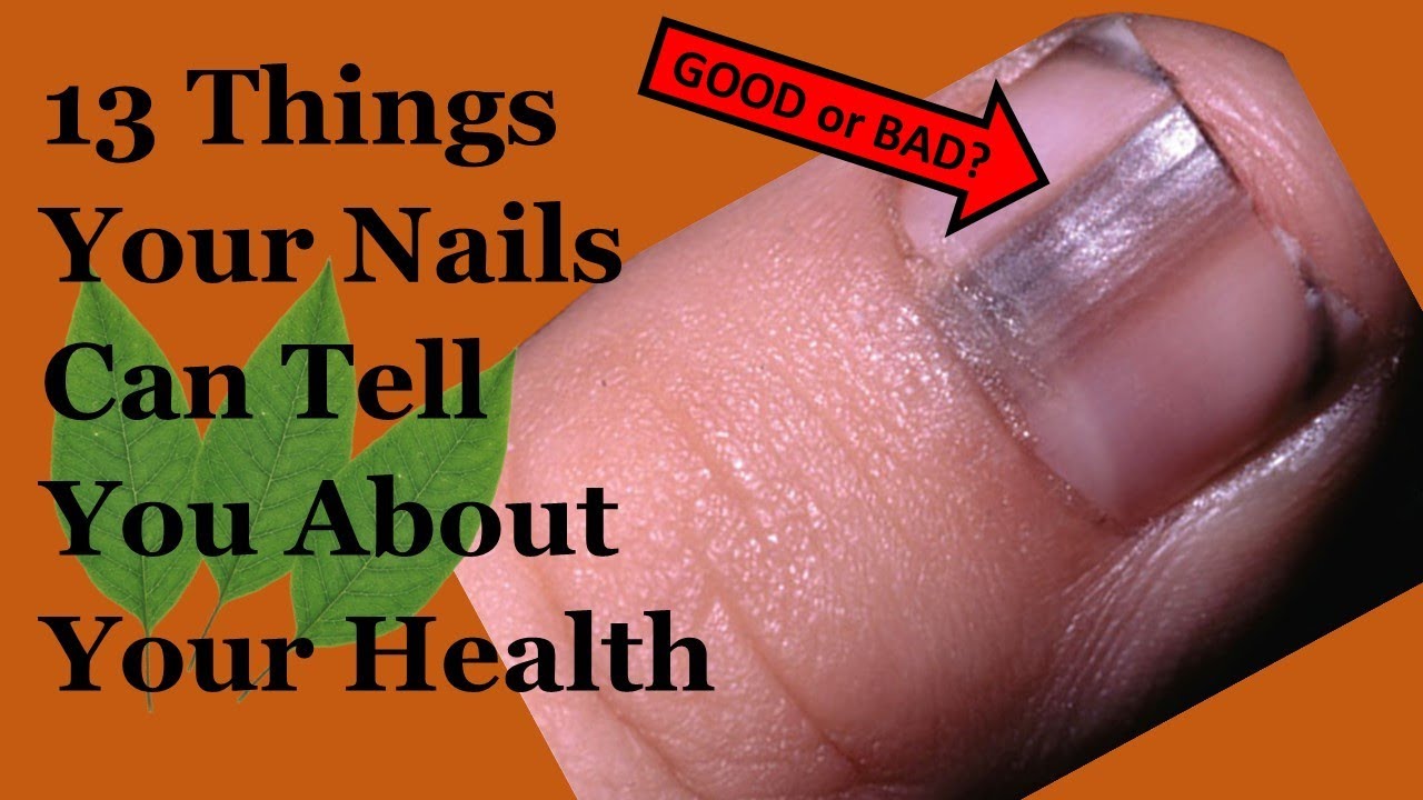 13 Things Your Nails Can Tell You About Your Health - YouTube
