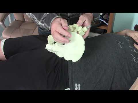 Sacrum Stuck and Lower Pelvic SIJD Sacroiliac Dysfunction Part 1 of 3