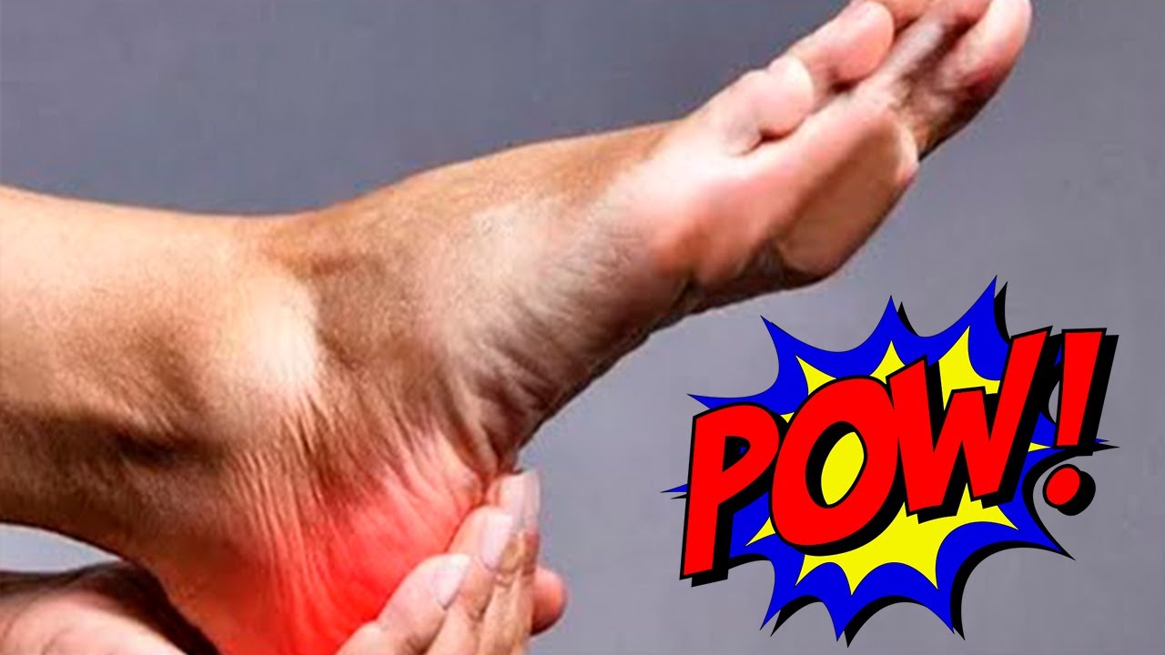 CÓMO CURAR EL DOLOR DE TALON. Fascitis plantar. 4 metodos Consejos ...