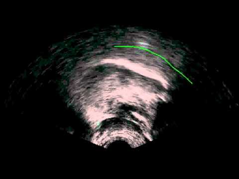 E voiced uvular fricative - YouTube