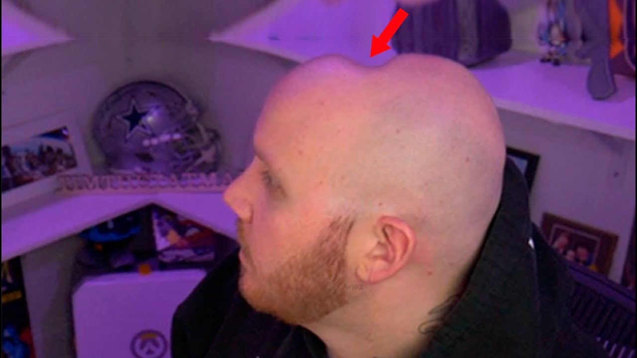 Streamers de todo el mundo están reportando que tienen un hoyo en la ...