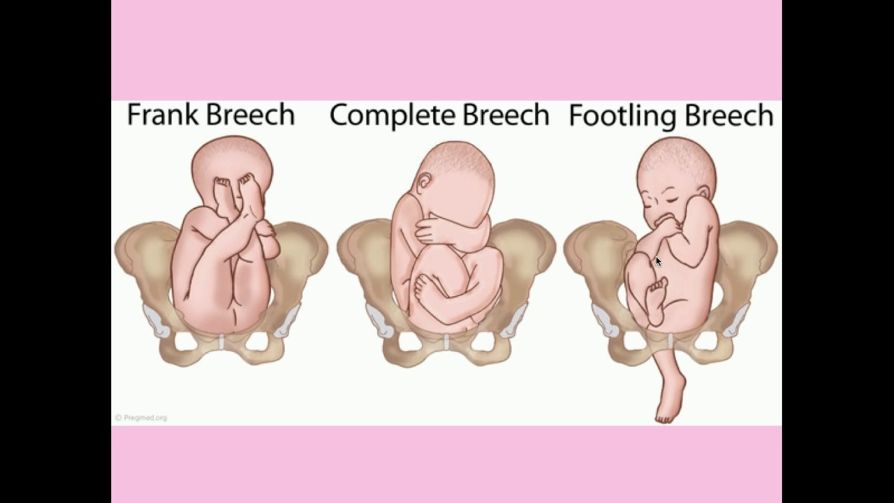 Normal Labor and Delivery - CRASH! Medical Review Series - YouTube