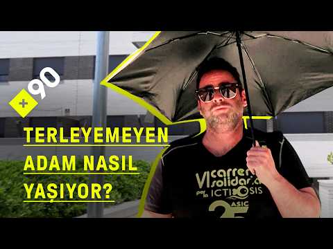 Balık pulu hastalığı: Bu adam terleyemiyor