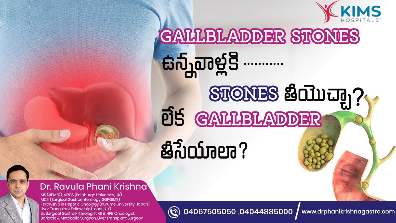 Gallbladder Stones: Remove Stones or Entire Gallbladder? Dr R Phani ...
