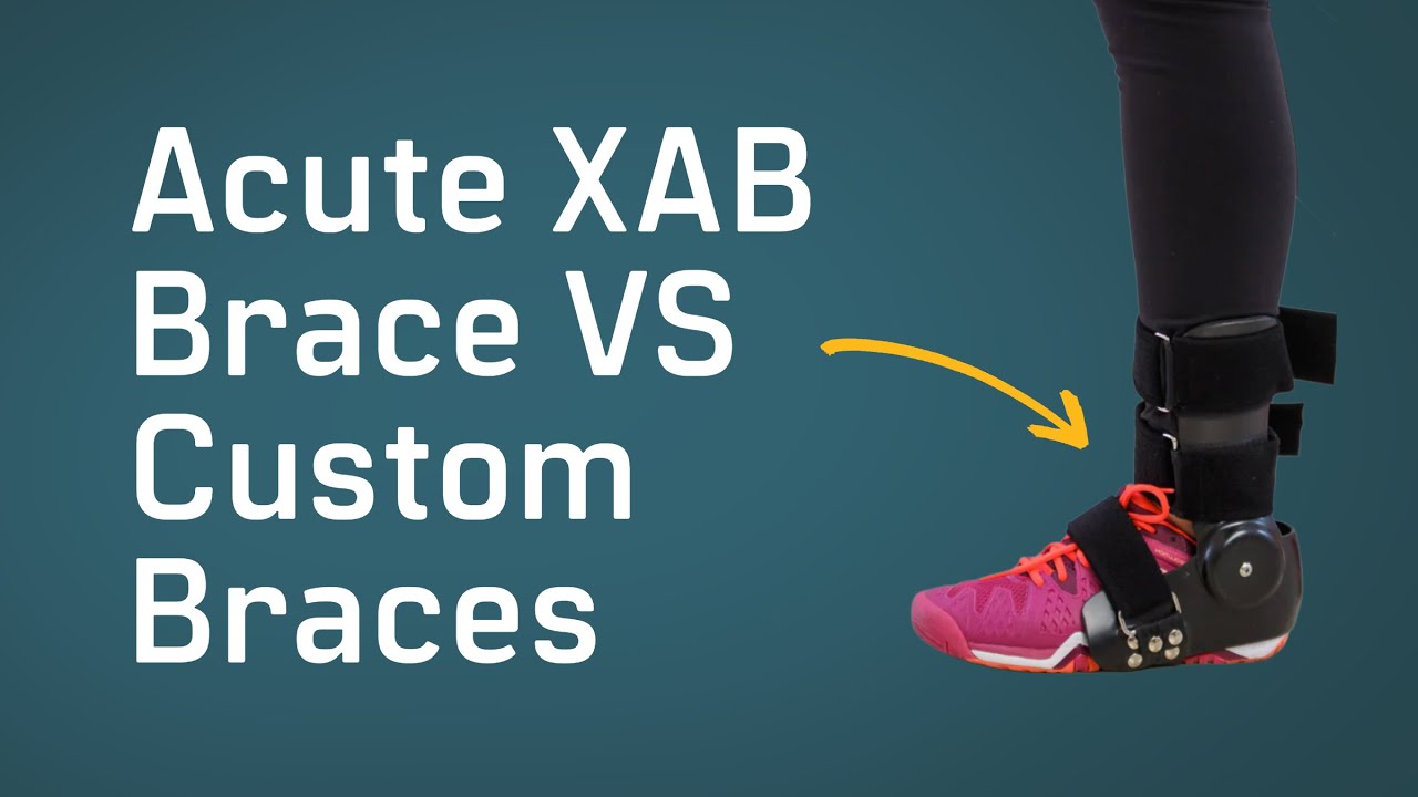 The Difference Between the XAB and Custom Braces - Doc Talk with Dr ...