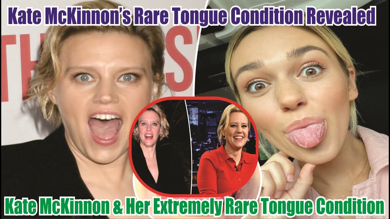 Kate McKinnon s Rare Tongue Condition Explained Symptoms, Cause & How ...