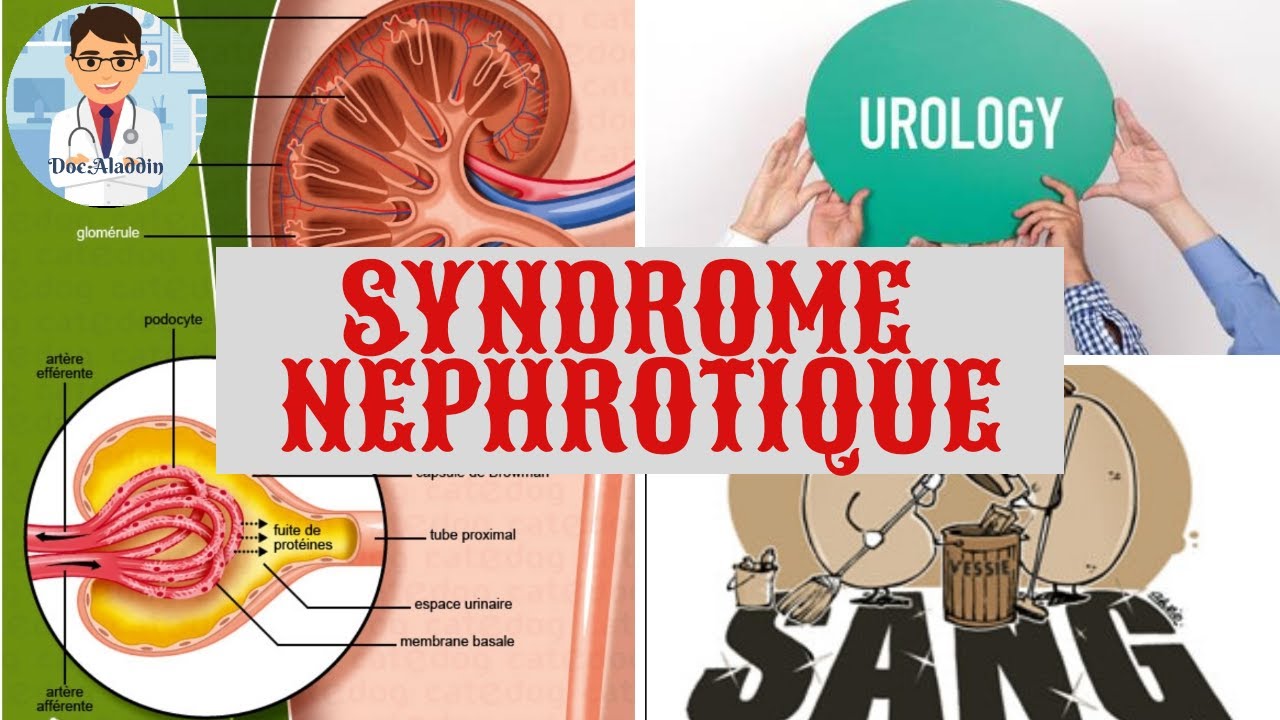 SYNDROME NEPHROTIQUE (DÉFINITION , PHYSIOPATHOLOGIE , CAUSE ...