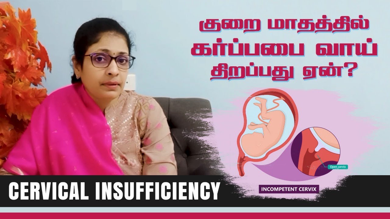 Cervical Insufficiency Dr S M SreDevi Tamil cervical-insufficiency-dr-s-m-sredevi-tamil