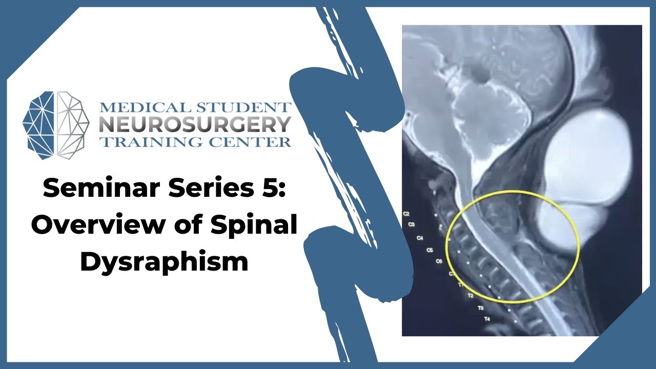 Seminar Series 5: Overview of Spinal Dysraphism - YouTube