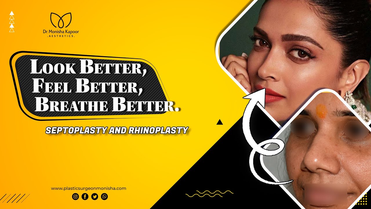 Desire Rhinoplasty like Celebrity Deepika Padukone | Rhinoplasty Nose ...