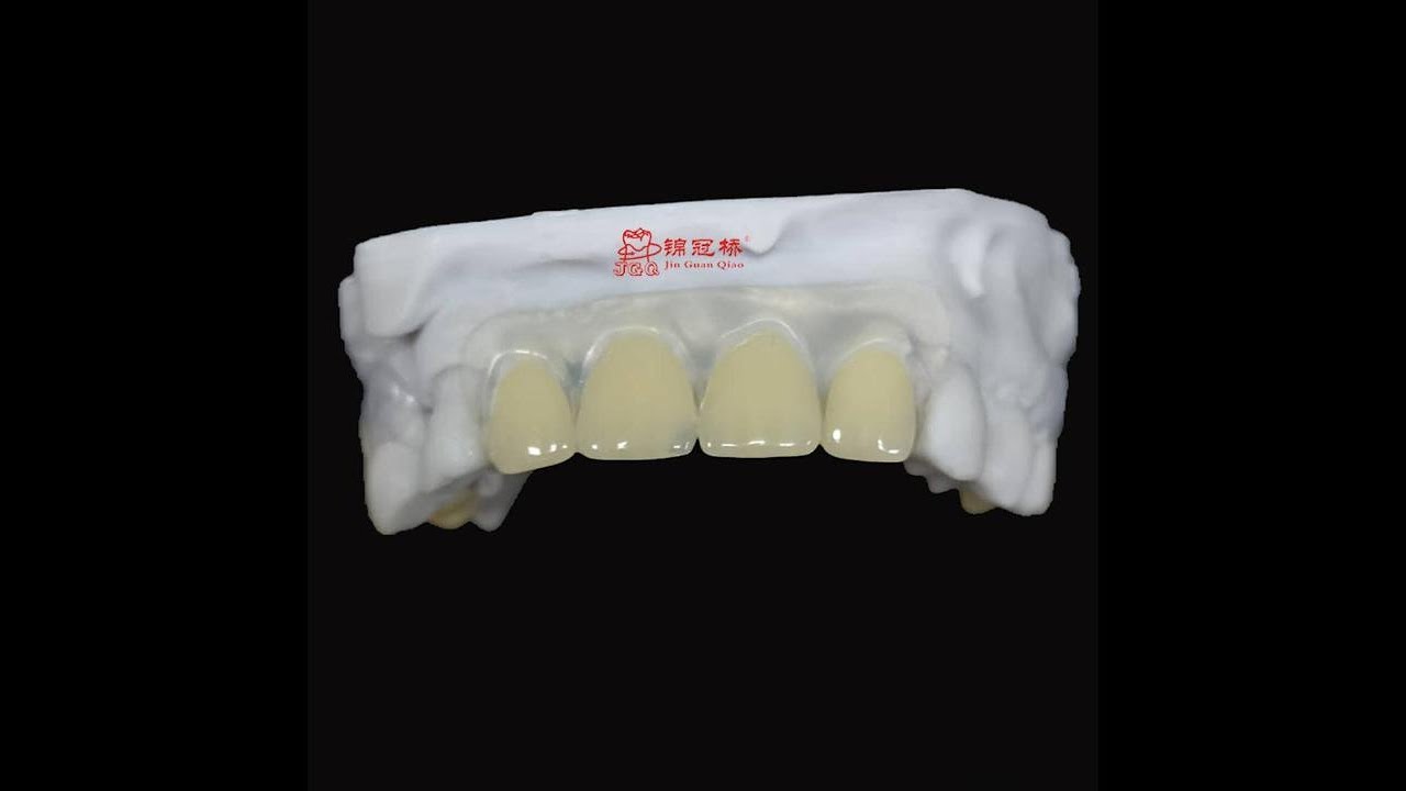Clear Valplast Removable Dentures - YouTube