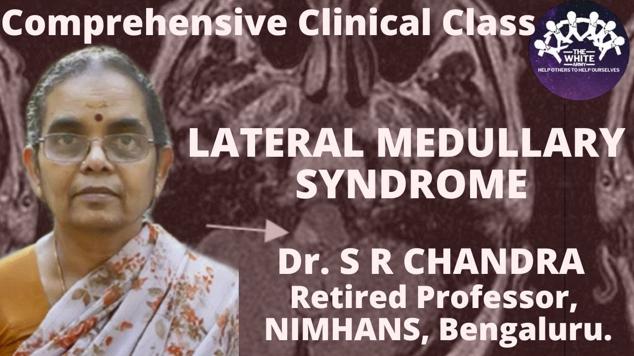Lateral Medullary Syndrome Case presentation - YouTube