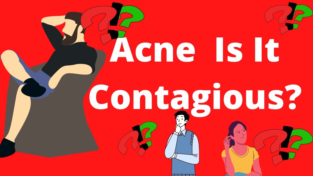 Acne Free Tips: Acne Is It Contagious? - YouTube