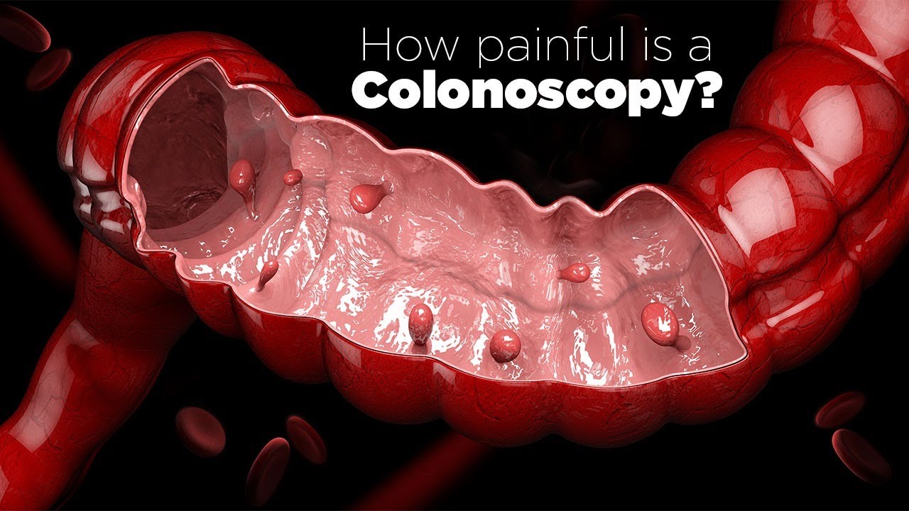 How painful is a colonoscopy? | Dr. Kunal Das, Gastroenterology ...