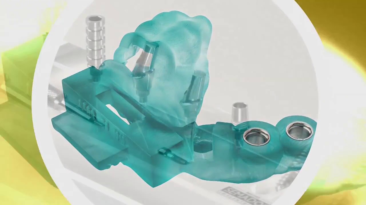 BEGO Implant Systems – Dental implants, made in Germany - YouTube