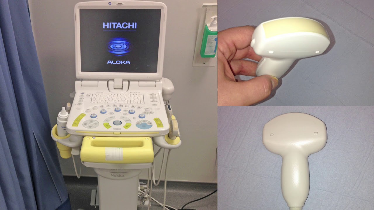 how to do a lumbar puncture using ultrasound - YouTube