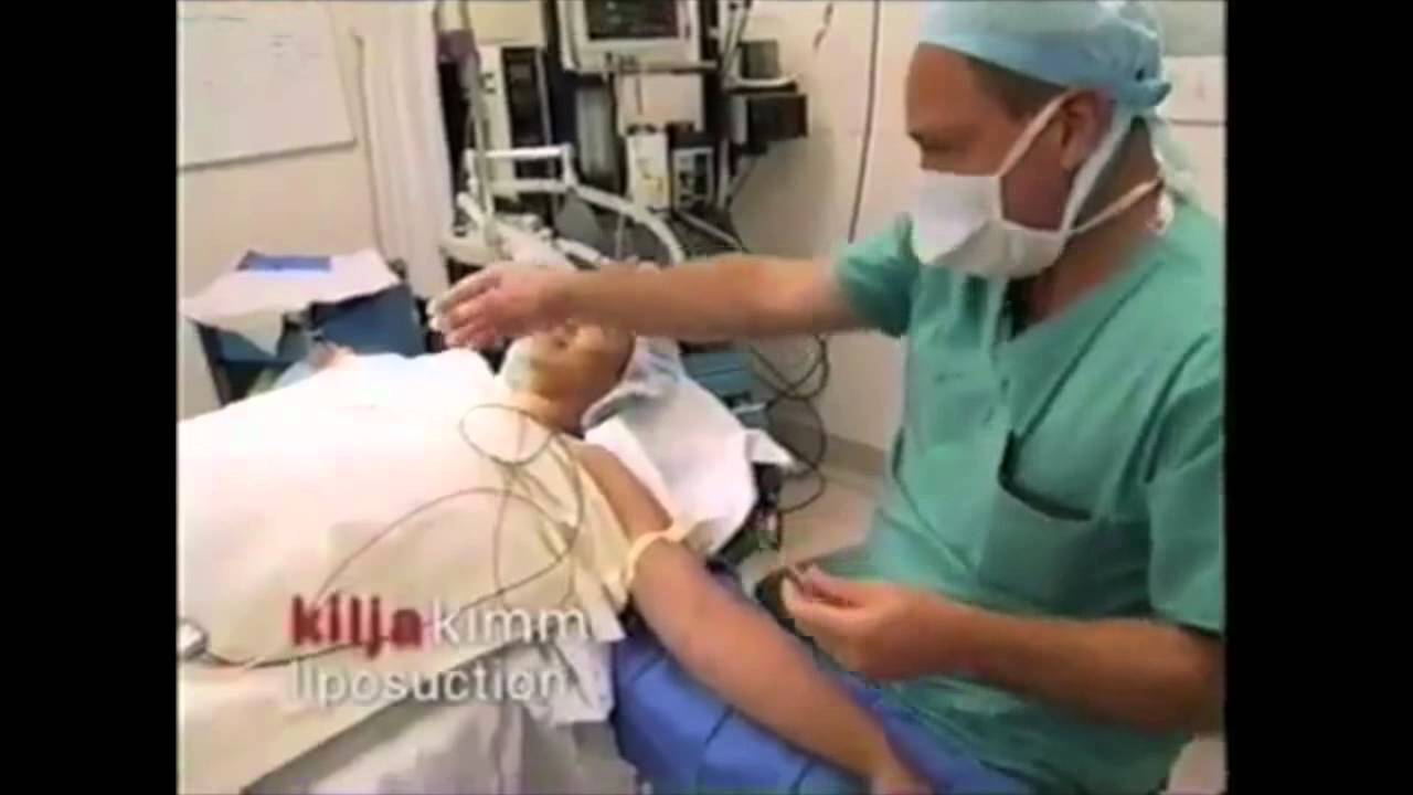 MicroAire - PAL LipoSculptor (liposuction and fat countouring) - YouTube