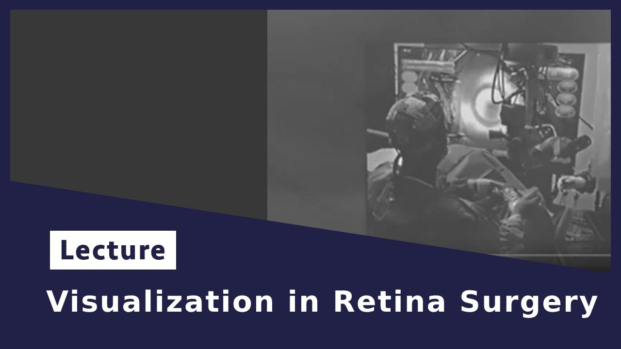 Visualization in Retina Surgery - YouTube