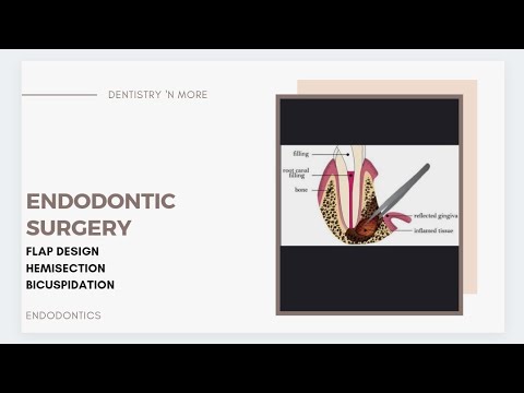 ENDODONTIC SURGERY || FLAP DESIGN || BICUSPIDATION || HEMISECTION - YouTube