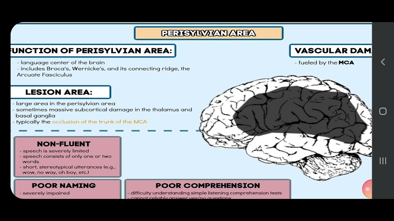Global Aphasia An overview - YouTube