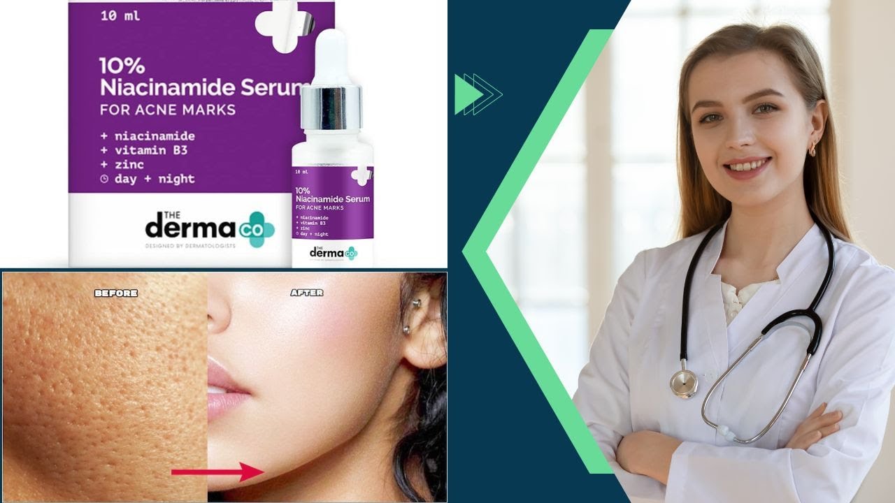 The Derma Co 10% Niacinamide Serum Review | In Hindi | Remove Acne ...