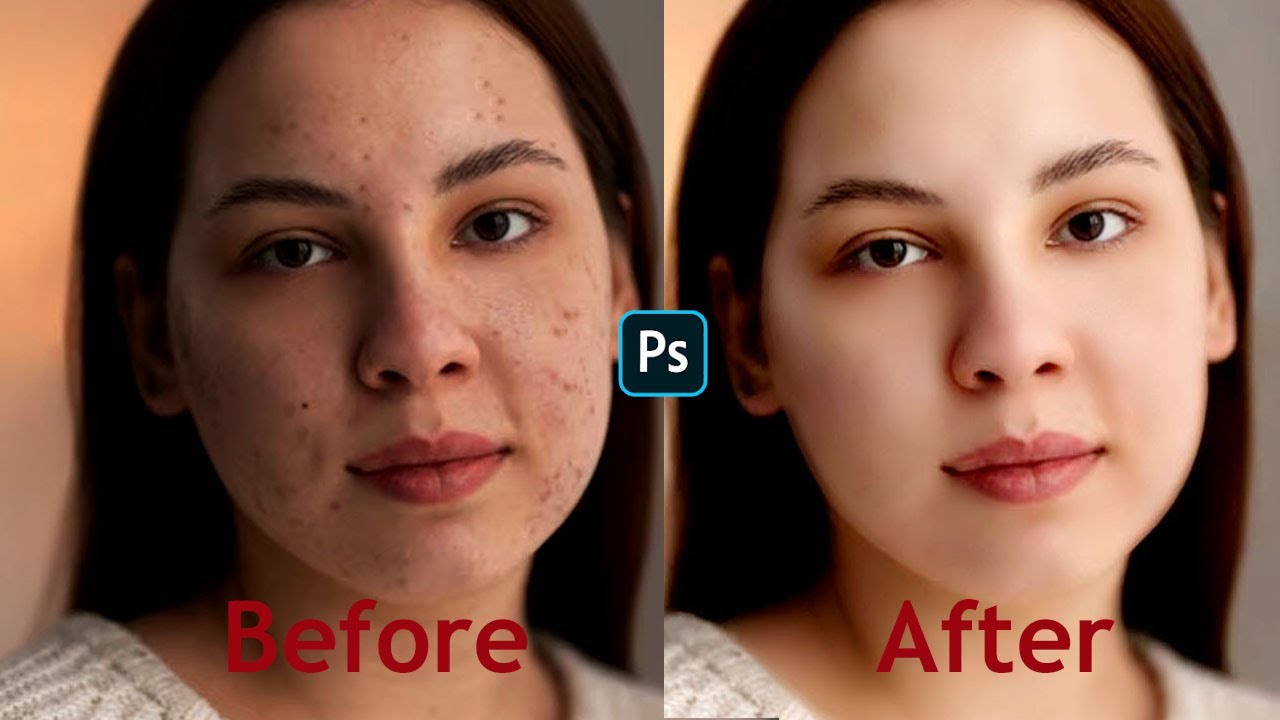 High End Skin Retouching in Photoshop l Skin Retouching Best Photoshop ...