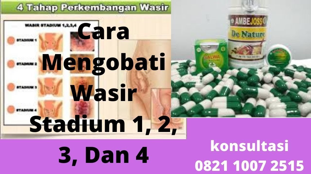 Cara Mengobati Wasir Stadium 1, 2, 3, Dan 4 - YouTube