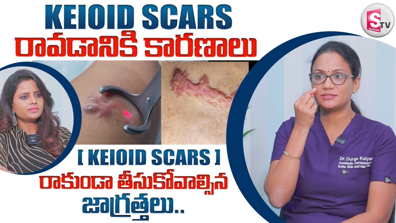 Keloid Scars: Causes & Treatment | Keha Skin & Hair Clinic | Dr. Durga ...