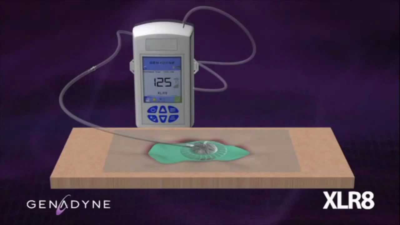 GENADYNE ESP-LOGO-HD.mp4 - YouTube