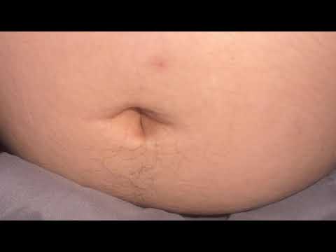 Sick tummy noises🤒