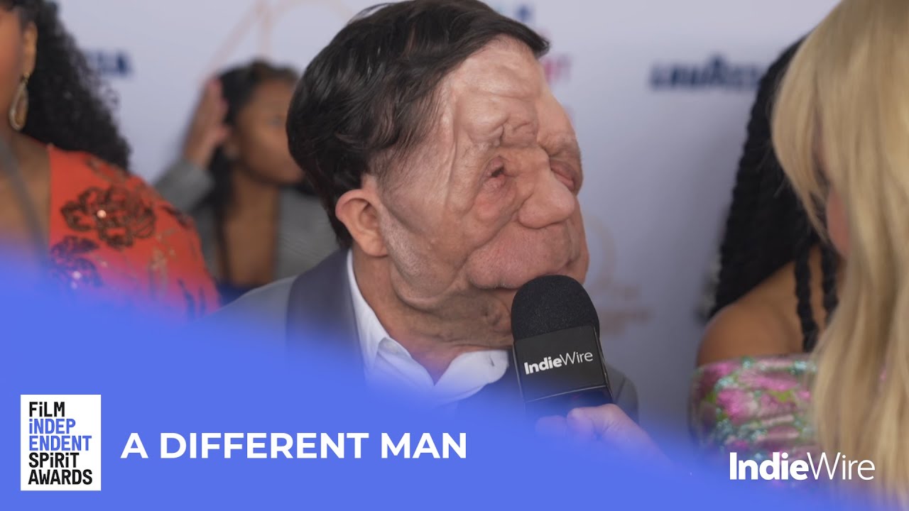 'A Different Man' Adam Pearson Gives Advice on Bothering Talent - YouTube