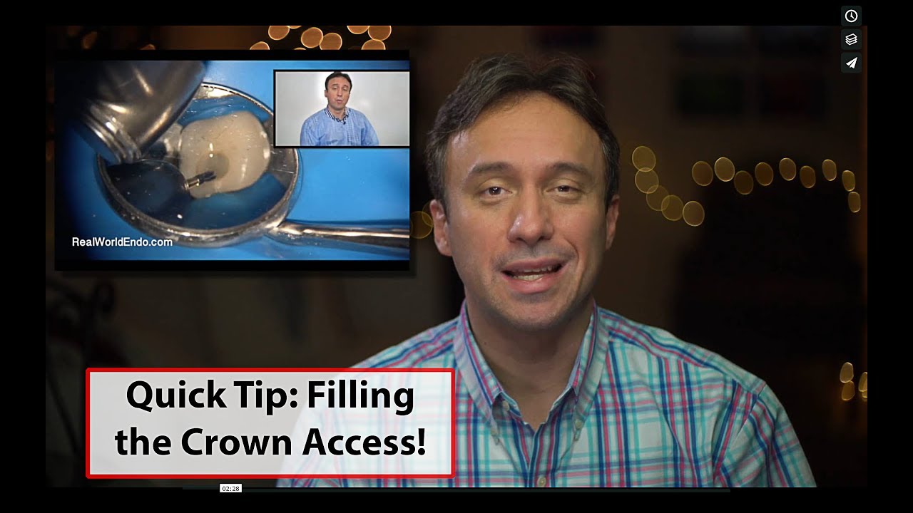Quick Tutorial: Filling Endo Access Through a Crown - YouTube