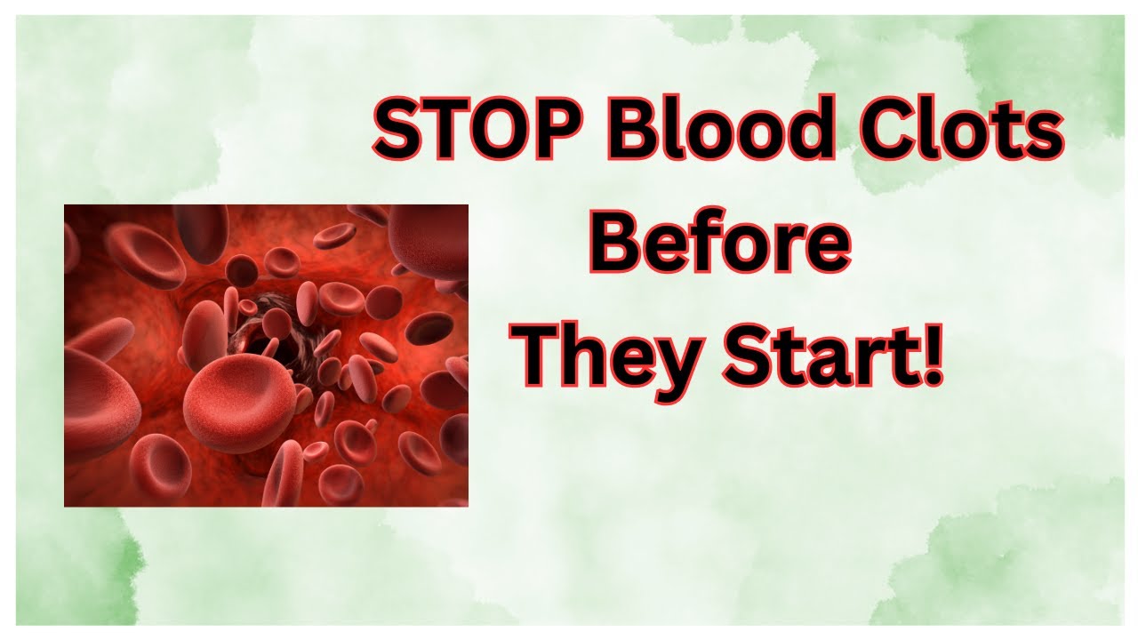 10 Best Foods to Prevent Blood Clots Naturally - YouTube