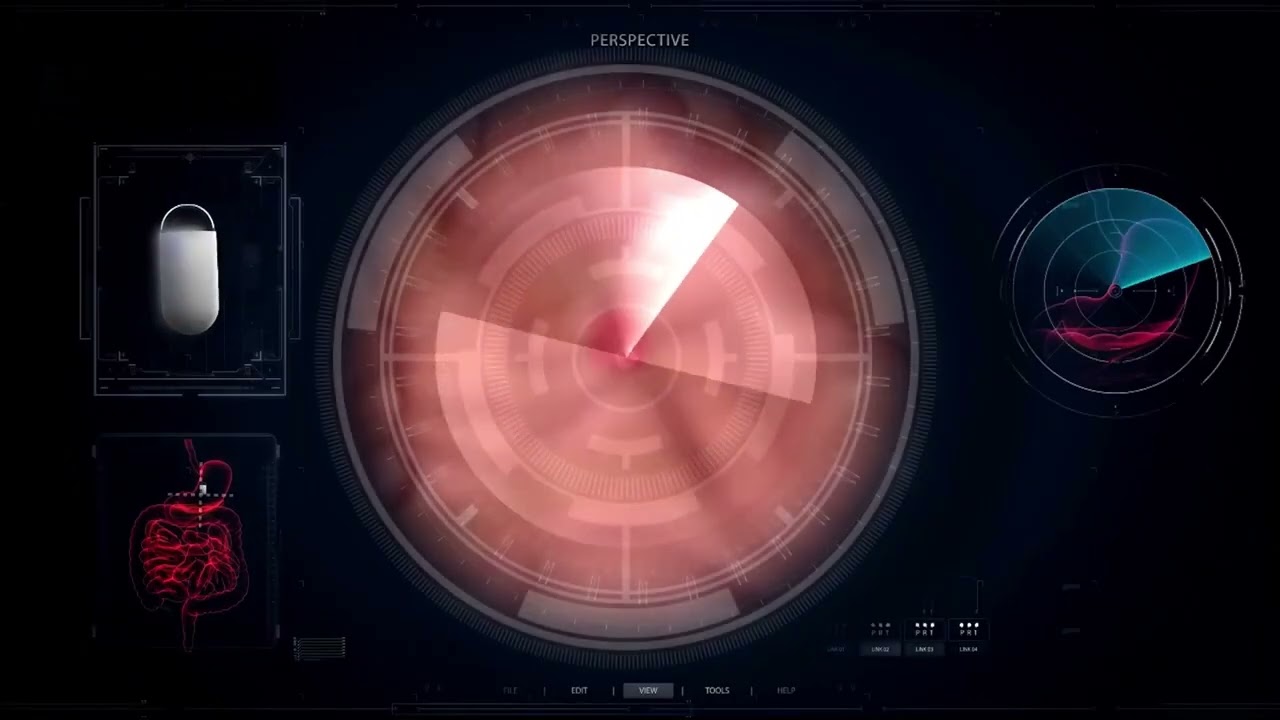 NaviCam - Stomach Capsule Endoscopy - YouTube