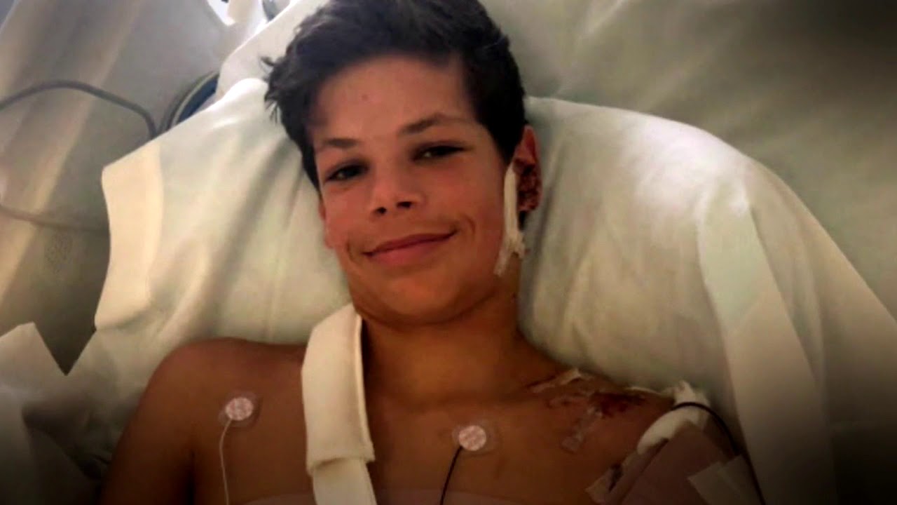ABC Exclusive: Shark attack survivor Keane Hayes speaks on his recovery ...